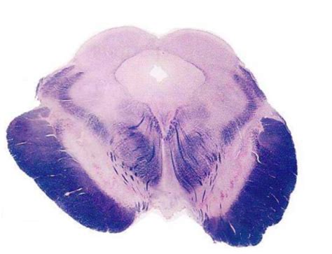 Cross Sections Flashcards Quizlet