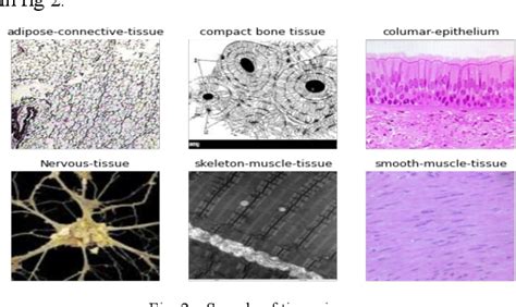 Figure From Epithelial Tissue Classification Using Pre Trained Deep Convolutional Neural