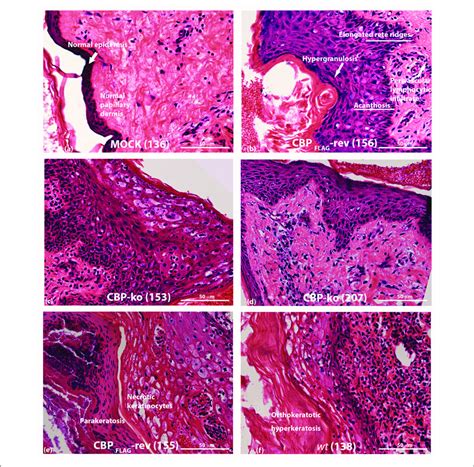 Histopathology Of Orfv Infected Skin Tissue H And E Stained Sections