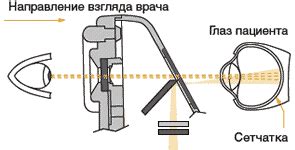 Как выбрать офтальмоскоп
