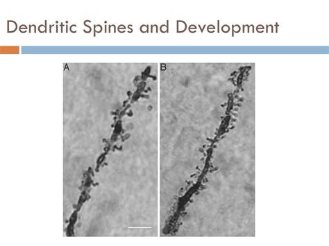 Ppt Synaptic Plasticity Iii Powerpoint Presentation Free Download Id2614881