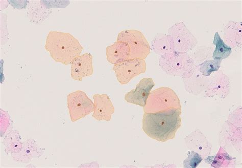 Pathology Image Annotation Done Right