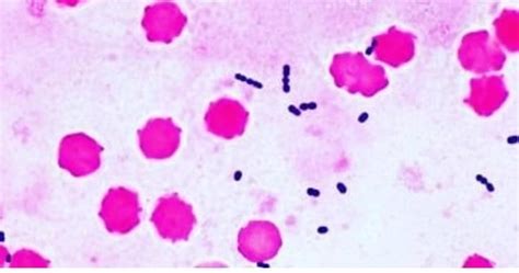 Gb Enterococcus Gallinarum Es Una Microbiologia Medica Facebook