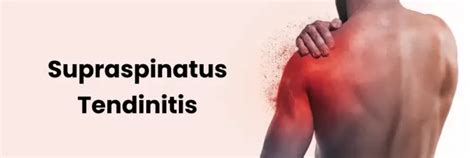 Supraspinatus Tendinitis Pain Relief Archives Mobility Physiotherapy
