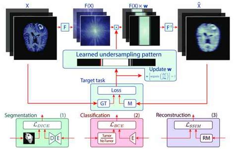 Optimal Mri Undersampling Patterns For Ultimate Benefit Of Medical