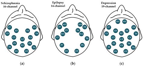 a lightweight multi mental disorders detection method using entropy based matrix from single
