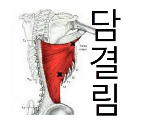 어깨 담 푸는법 옆구리 결림 해소법 네이버 블로그