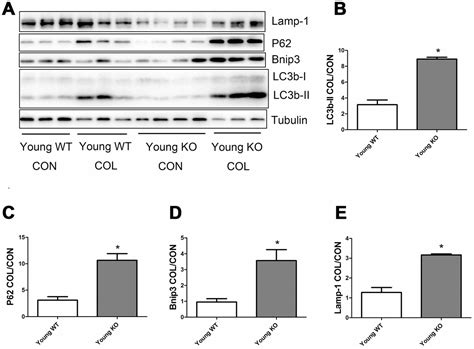 Nrf2 Deficiency Promotes The Increasing Trend Of Autophagy During Aging