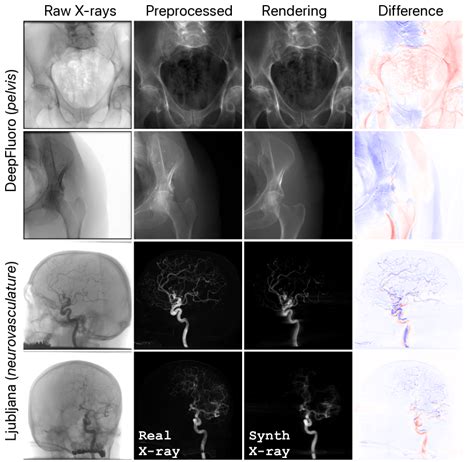 231206358 Intraoperative 2d3d Image Registration Via Differentiable X Ray Rendering