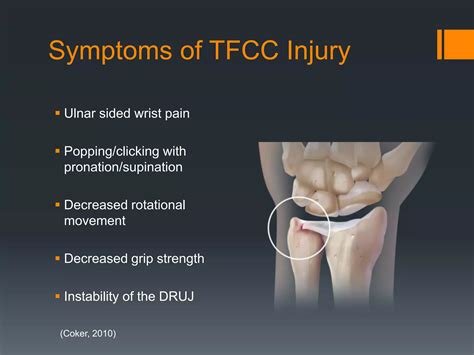 The Distal Radioulnar Joint And Tfcc Pptx