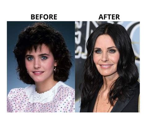 Courteney Cox S Plastic Surgery Secrets Revealed Fabbon