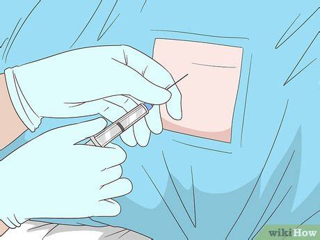 How To Treat A Pinched Nerve