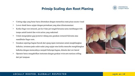 Skill Lab Scaling Manual Dan Ultra Sonic Scaler PPTX