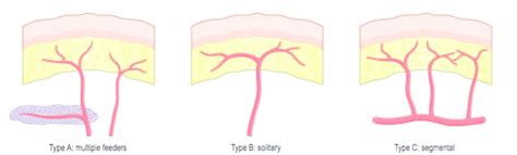 Classification De Cormack Et Lamberty Diffrenciant Les Types En Download Scientific Diagram
