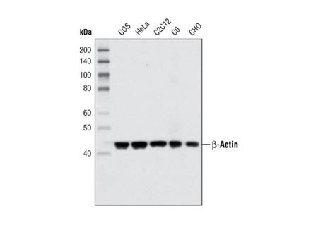 β Actin Antibody Cell Signaling Technology