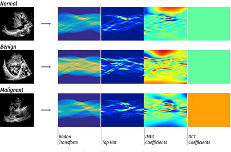 Figure 2 From Automated Diagnosis Of Focal Liver Lesions Using