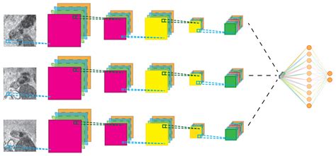 Lymph Node Detection In MR Lymphography False Positive Reduction Using Multi View Convolutional