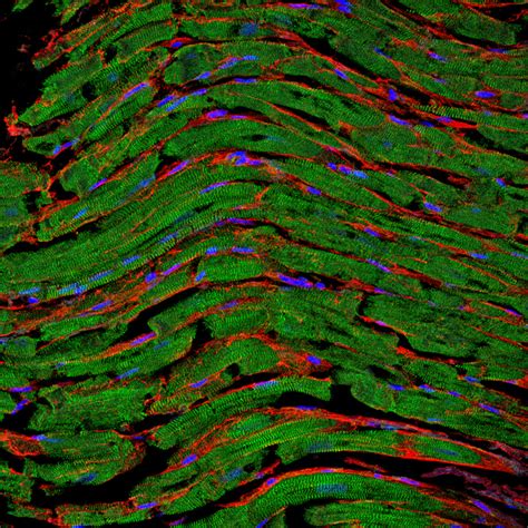 Representative Fluorescence Staining Of Paraffin Embedded Cardiac