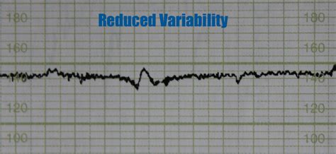 بهترین تداوی وقایه است Ctg