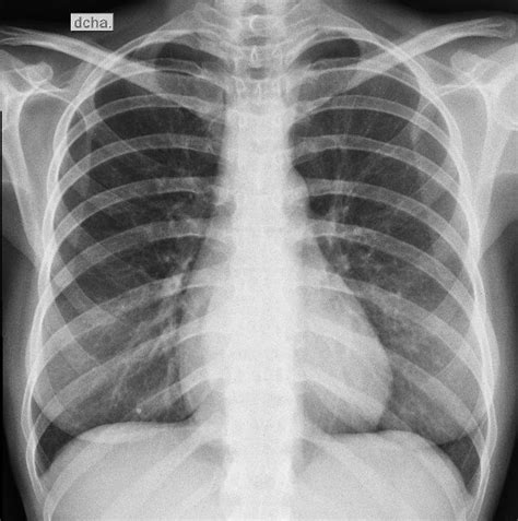 El RincÓn De La Medicina Interna Juanpedromacalusoar