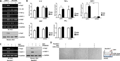 Gm1 Enhances Huvec Tube Formation Via Secretion Of Mcp 1 From Raw264 7 Download Scientific