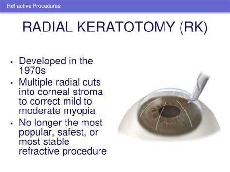Ppt Refractive Surgery Powerpoint Presentation Free Download Id 3398255