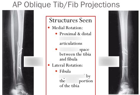 RTCA 141 Week 2 Tib Fib Knee Distal Femur AP Oblique Tib Fib