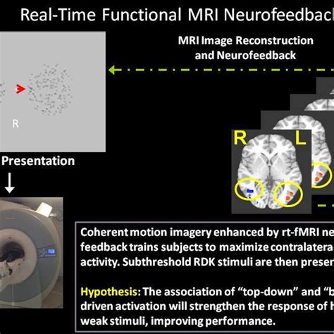 The Population Receptive Field Prf Model This Model Estimates The