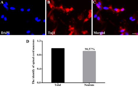 The Morphology Of Cultured Spinal Neurons In Vitro A Dapi Blue Download Scientific Diagram