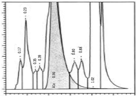 Hplc Variant 2 Turbo Chromatogram For Hb A1c Analysis Shows Very