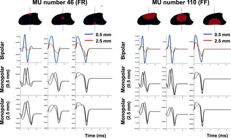 Motor Unit Action Potentials Of Two Representative Motor Units Recorded