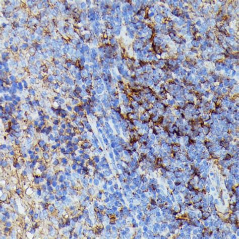Anti Hla Class 1 Abc Antibody A8902