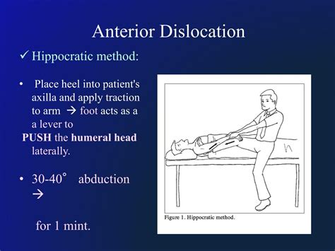 Ppt Shoulder Dislocation Powerpoint Presentation Free Download Id 4841498