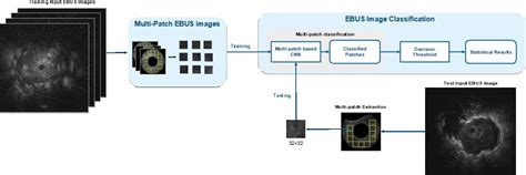 Figure 48 From Pulmonary Lesion Classification Using Convolutional Neural Network For