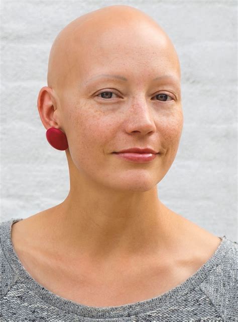 Author Helen Phillips On Living With Alopecia Refinery29uk Bald