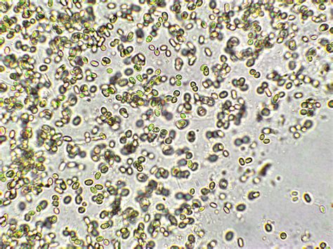 Algae Under Microscope