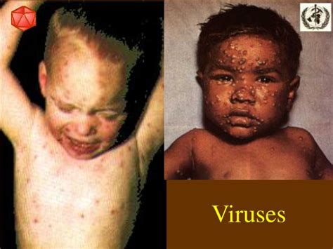 PPT Viruses PowerPoint Presentation Free Download ID 3499367