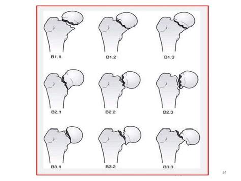 Nof Anatomy