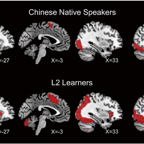 Brain Activation Of The Task Compared With The Baseline In The Two Download Scientific Diagram
