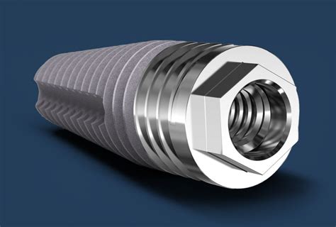 Implante Dental Msc Southern Implants Ibérica