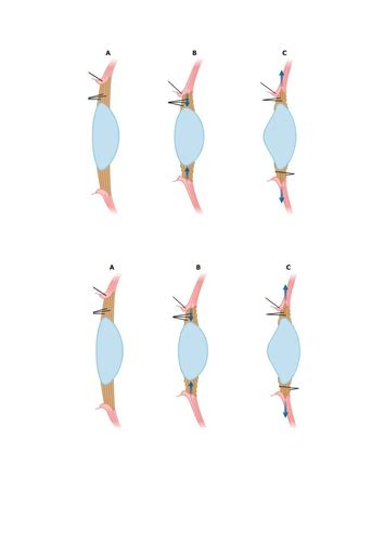 New Gcse Aqa B10 The Human Nervous System Teaching Resources