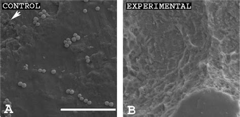 Scanning Electron Microscopy Confirms Inhibition Of Bacterial Download Scientific Diagram