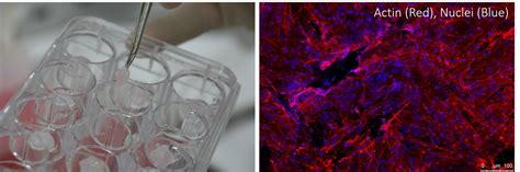 Human Ecm Max Planck Queensland Centre