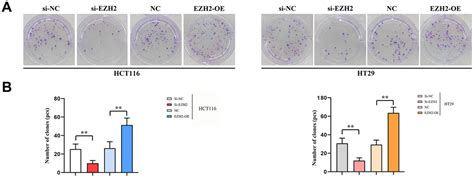Down Regulation Of Ezh2 Genes Targeting Runx3 Affects Proliferation