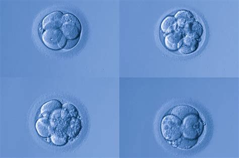 Embryo Grading Finest Fertility Clinic In India