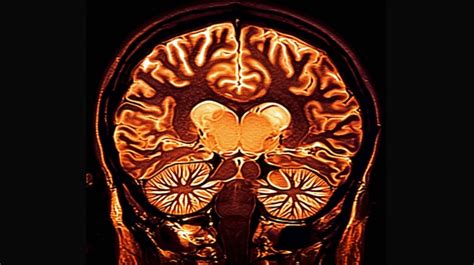 Neural Pathways In Brain Mri Scan Medical Imaging Closeup Premium Ai Generated Image