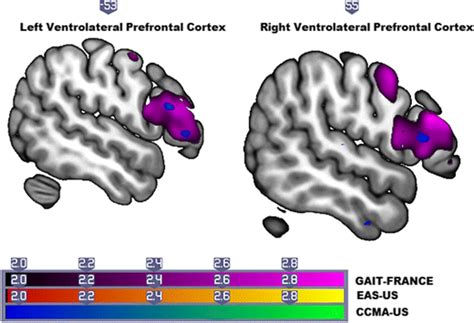 Shared Regions In The Gray Matter Covariance Networks Associated With