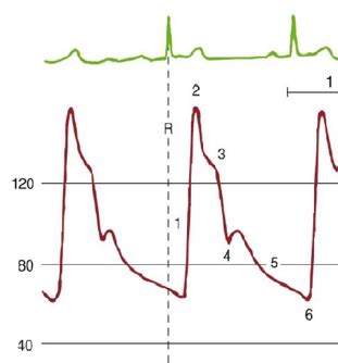 A Line And CVP Waveform Identifications Flashcards Quizlet