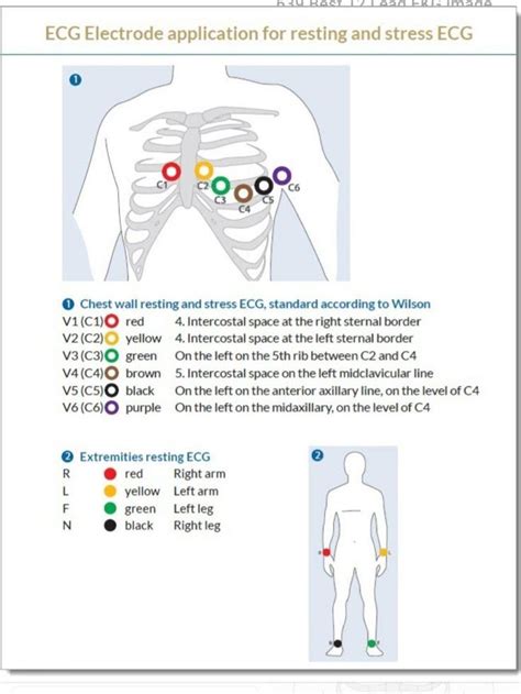 Ekg Readings Artofit