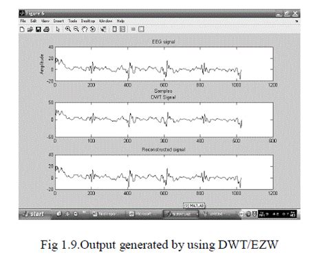 Generation And Reconstruction Of EEG Signals Using Matlab Open Access Journals